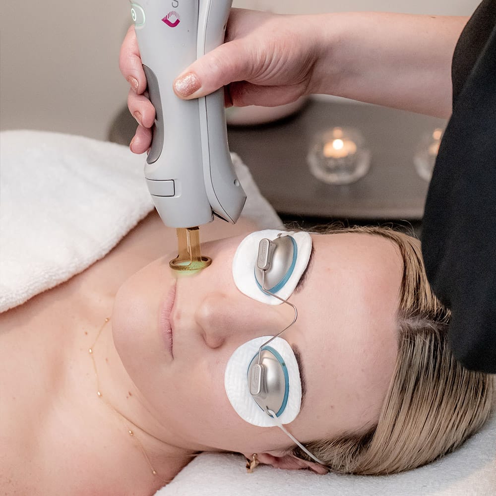 Gore Laser Treatments - Affordable, Gentle Lazer Treatments